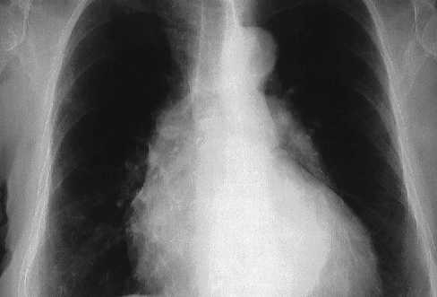 Radiografías simples: una Introducción